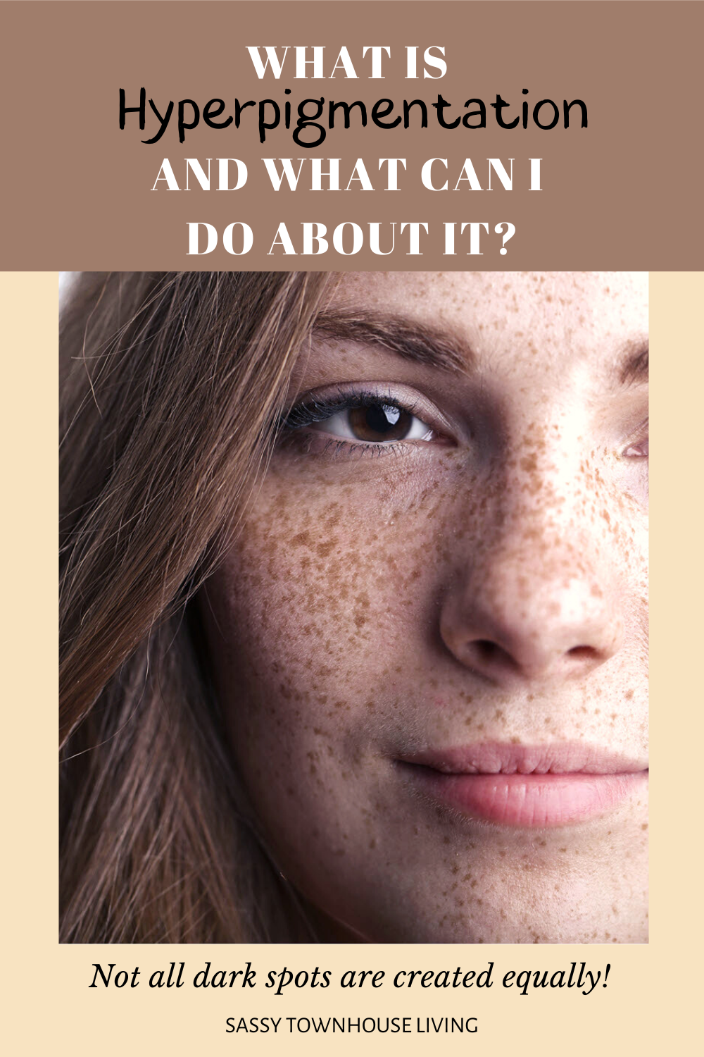 What is Hyperpigmentation And What Can I Do About It?